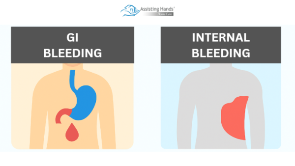 How Long Can Seniors Live with Internal Bleeding? | Senior Guide